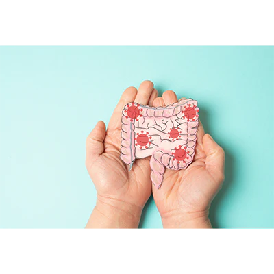 Diversion Colitis: Symptoms, Risks, and Effective Treatments