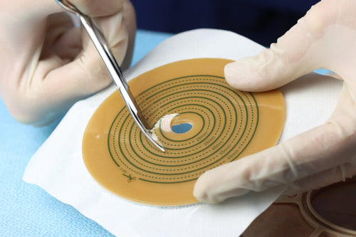 Colostomy Output Guide: High, Normal, Low Levels & What They Mean
